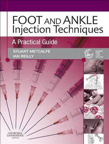 Studieshop | Foot and Ankle Injection Techniques, Metcalfe, Stuart ...